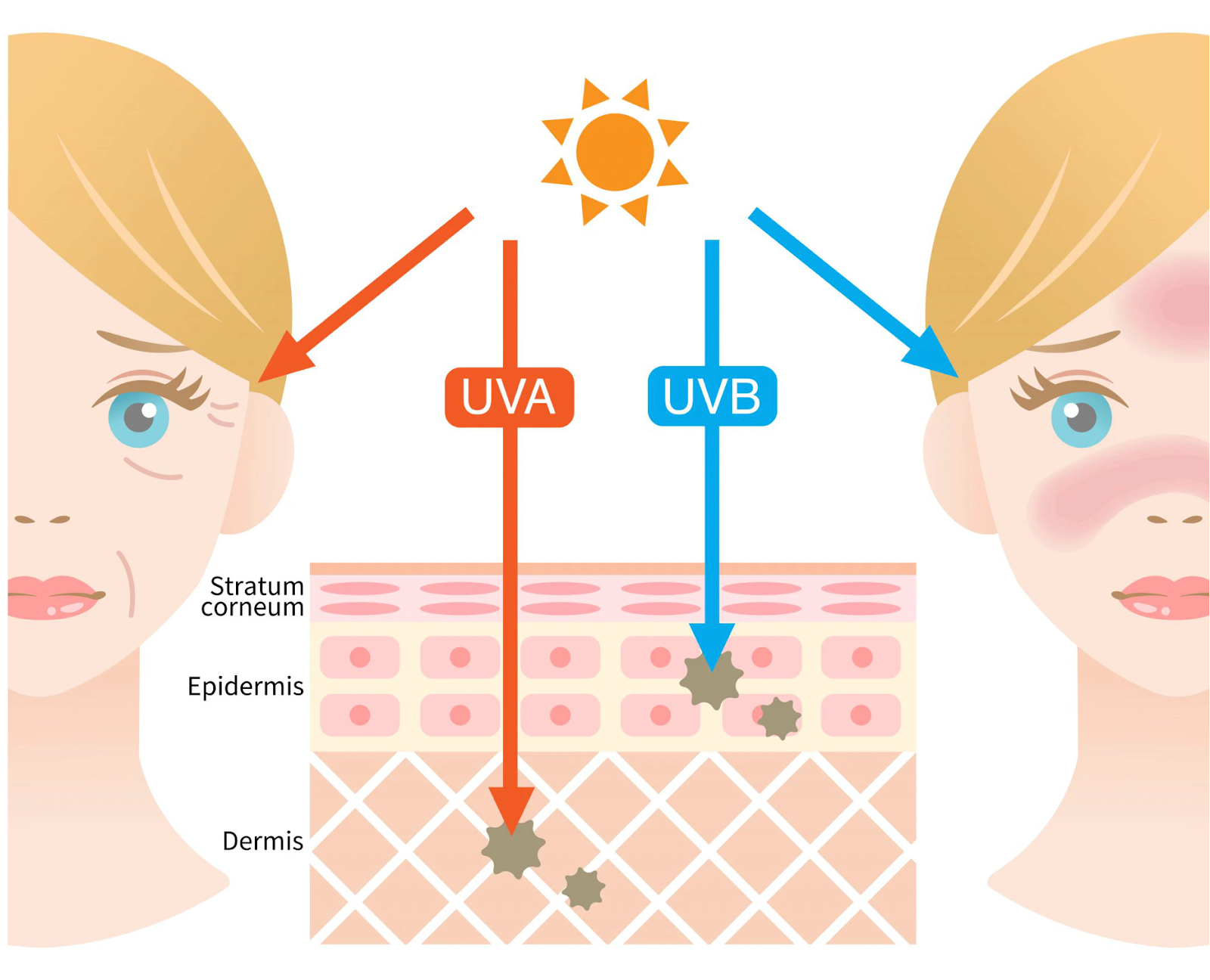Understanding the Impact of UV Rays on Your Skin - CULT